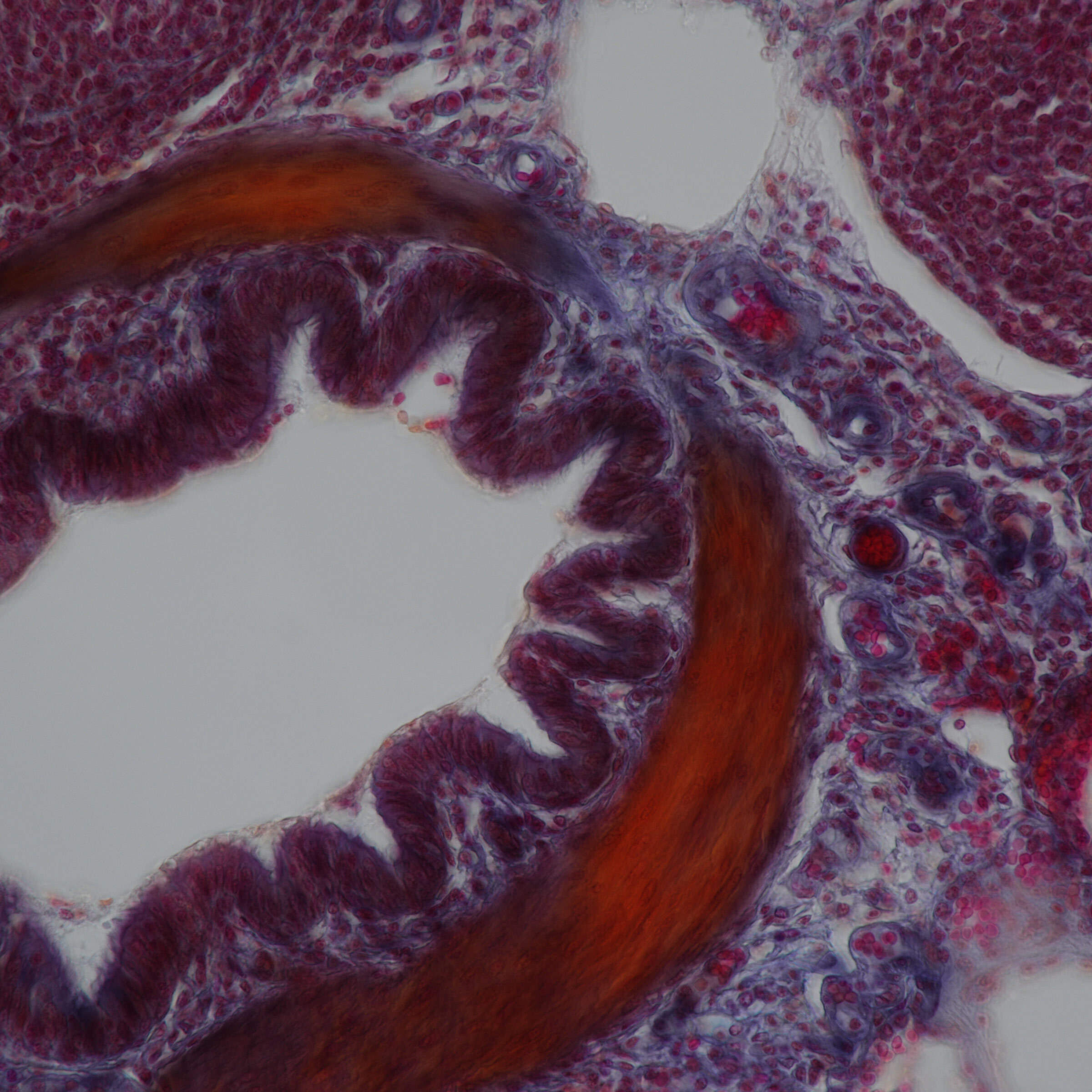 Lung tissue section | Galleries | Nikon Corporation Healthcare Business ...