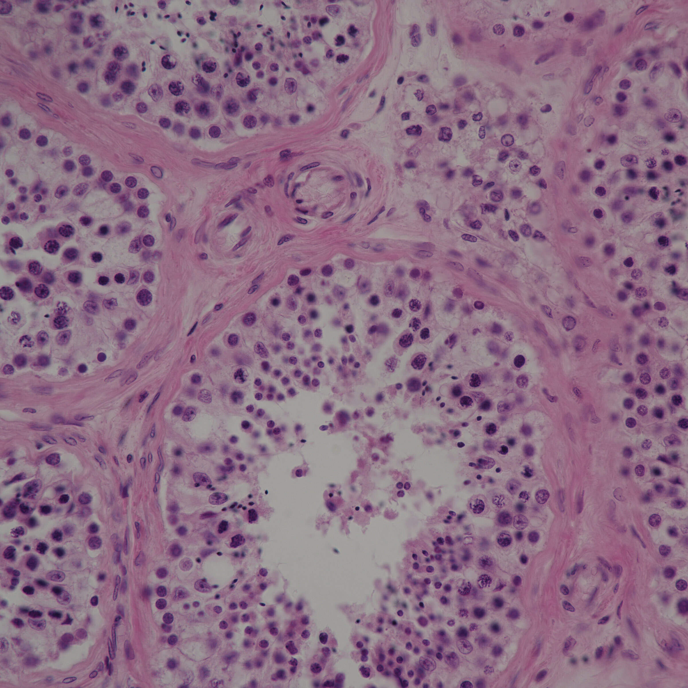 H&E-stained testis tissue section | Galleries | Nikon Europe B.V.