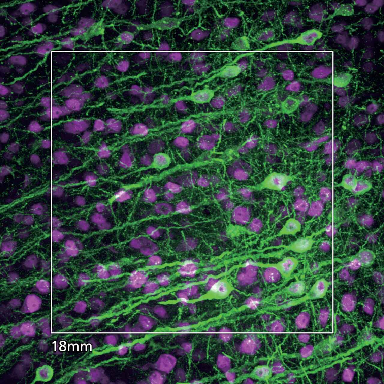 A1 HD25 / A1R HD25 | Confocal Microscopes | Nikon Instruments Products ...