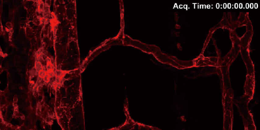 A1 HD25 / A1R HD25 | Confocal Microscopes | Products | Nikon ...