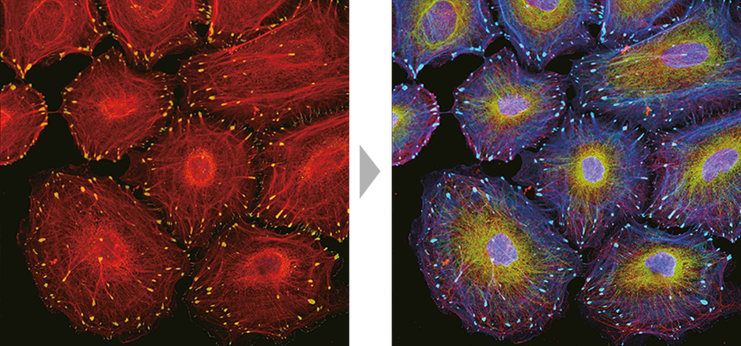 A1 HD25 / A1R HD25 | Microscopios confocales | Productos | Nikon ...