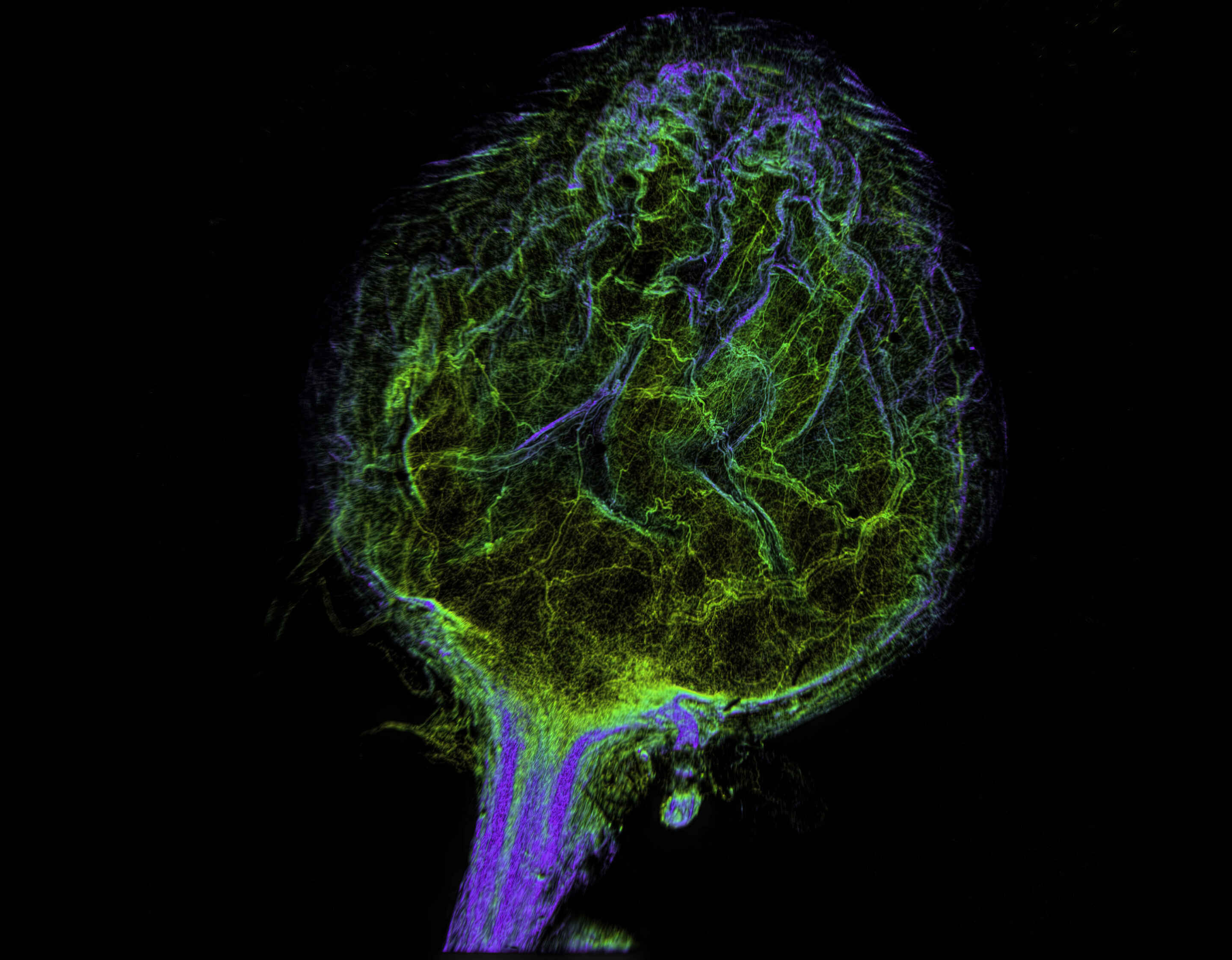 AX / AX R | Confocal Microscopes | Nikon Instruments Products | Nikon ...