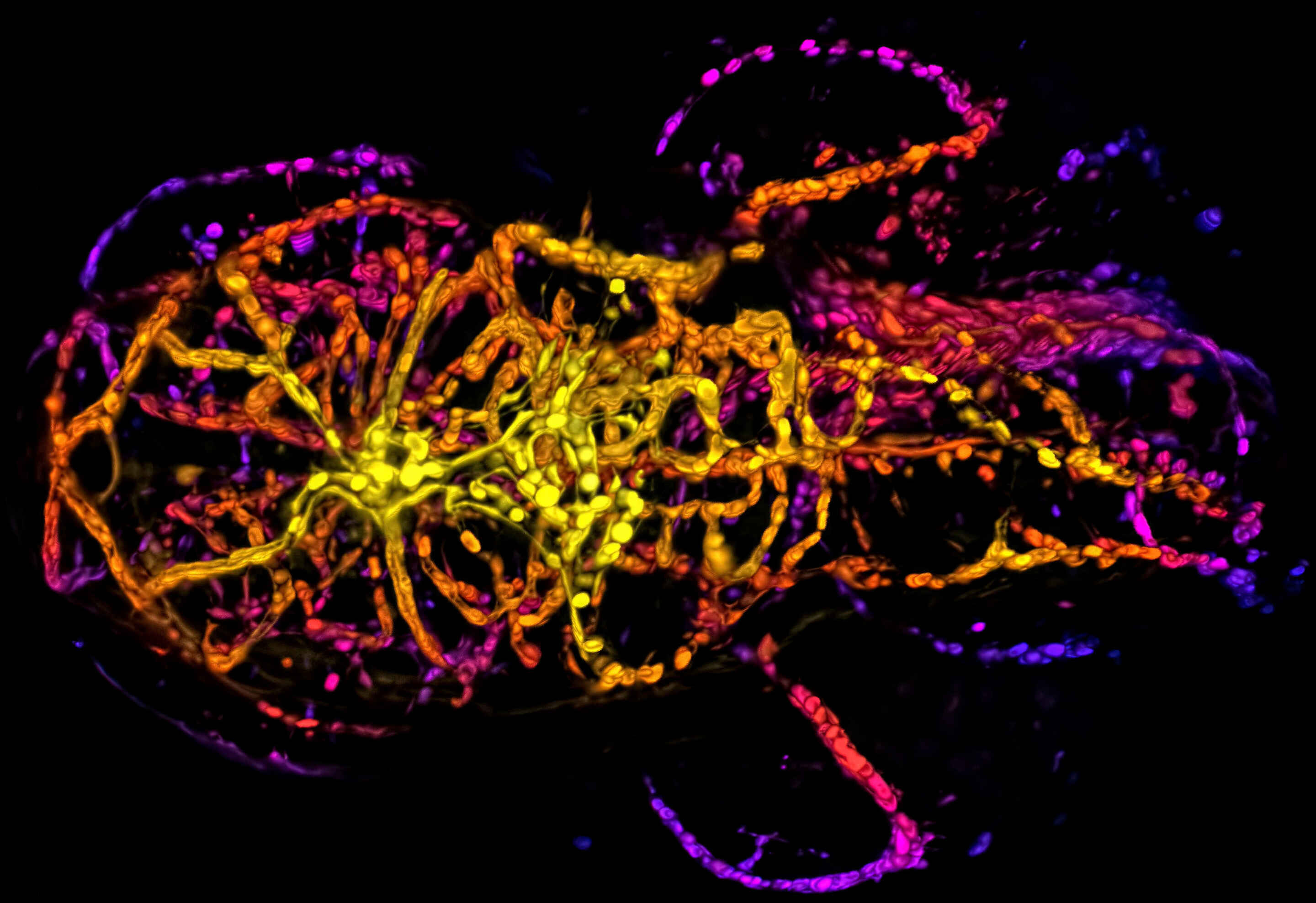 AX / AX R | Confocal Microscopes | Nikon Instruments Products | Nikon ...