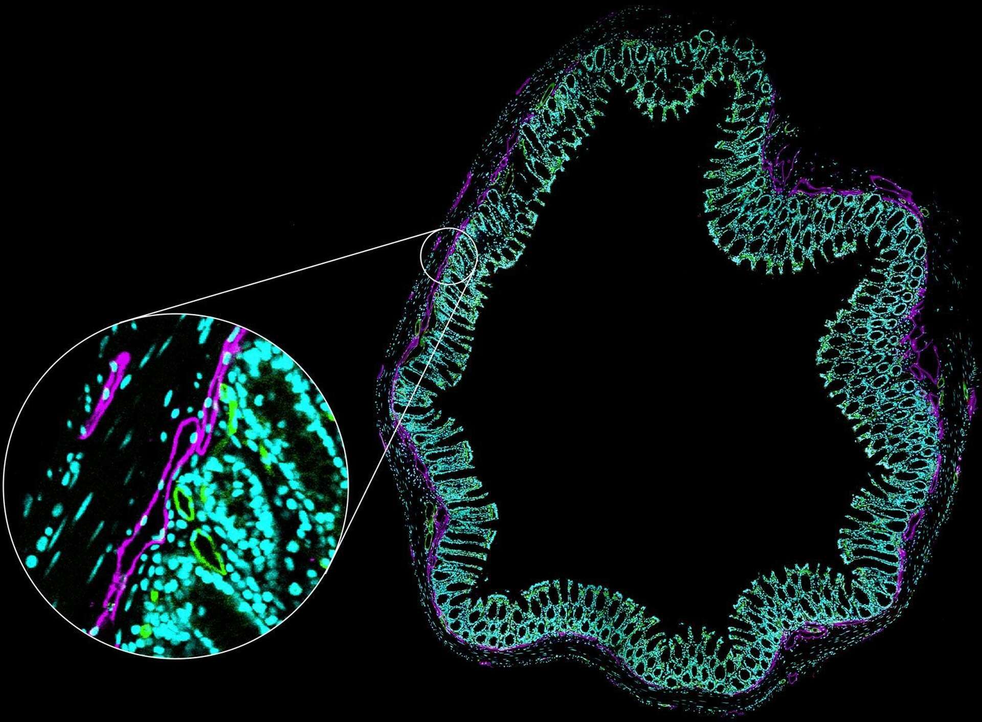 AX / AX R | Confocal Microscopes | Nikon Instruments Products | Nikon ...