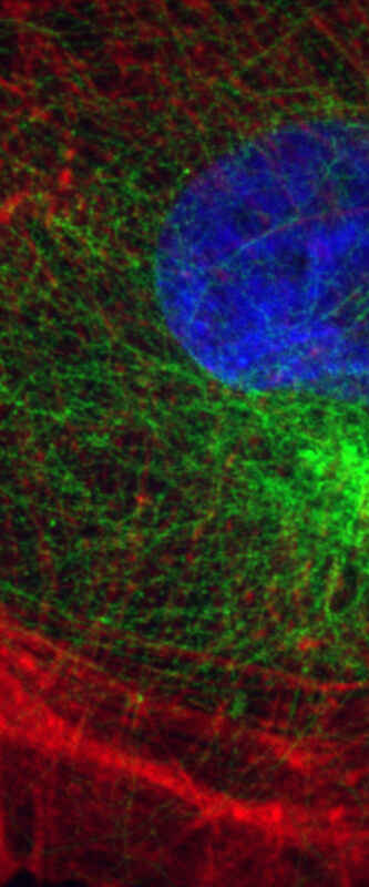 CSU-W1 SoRa | CSU Series | Confocal Microscopes | Products | Nikon ...