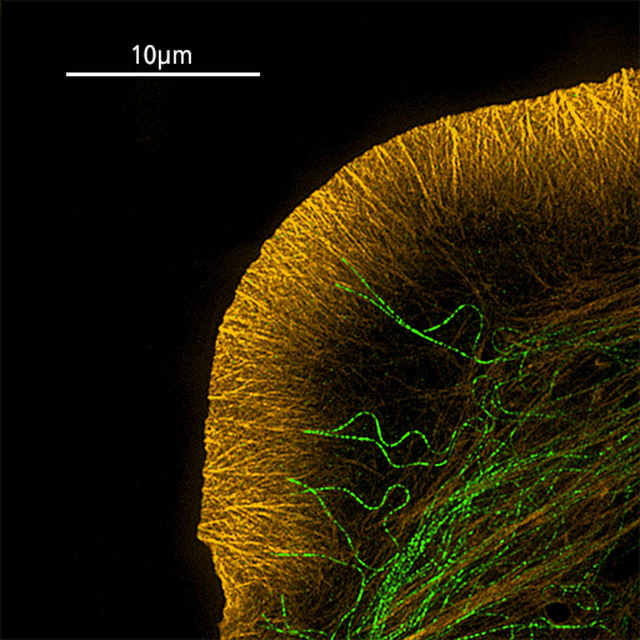 N-SIM E | Super-Resolution Microscopes | Products | Nikon Corporation ...