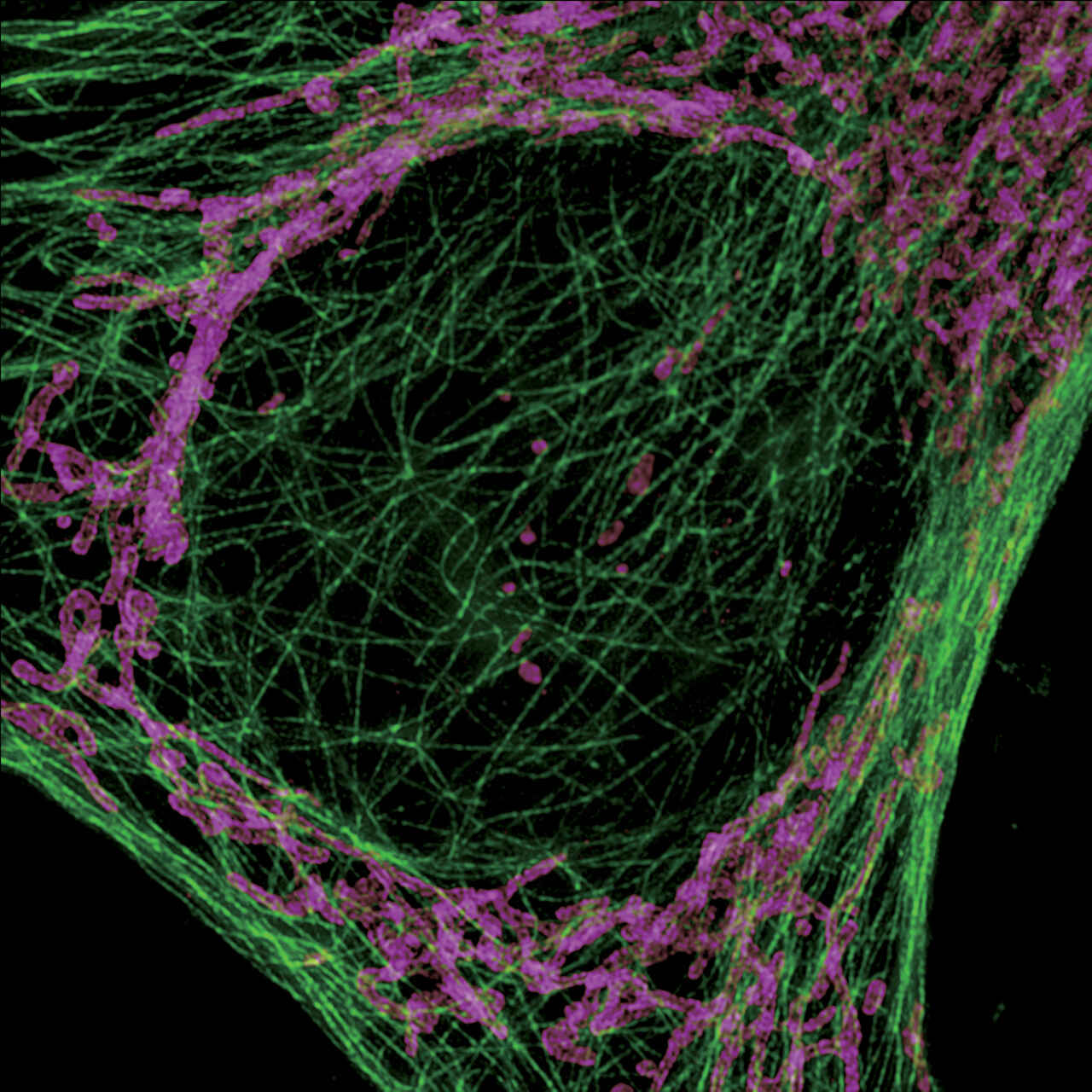 N-SIM E | 超分辨显微镜 | 尼康仪器产品 | 尼康仪器（上海）有限公司