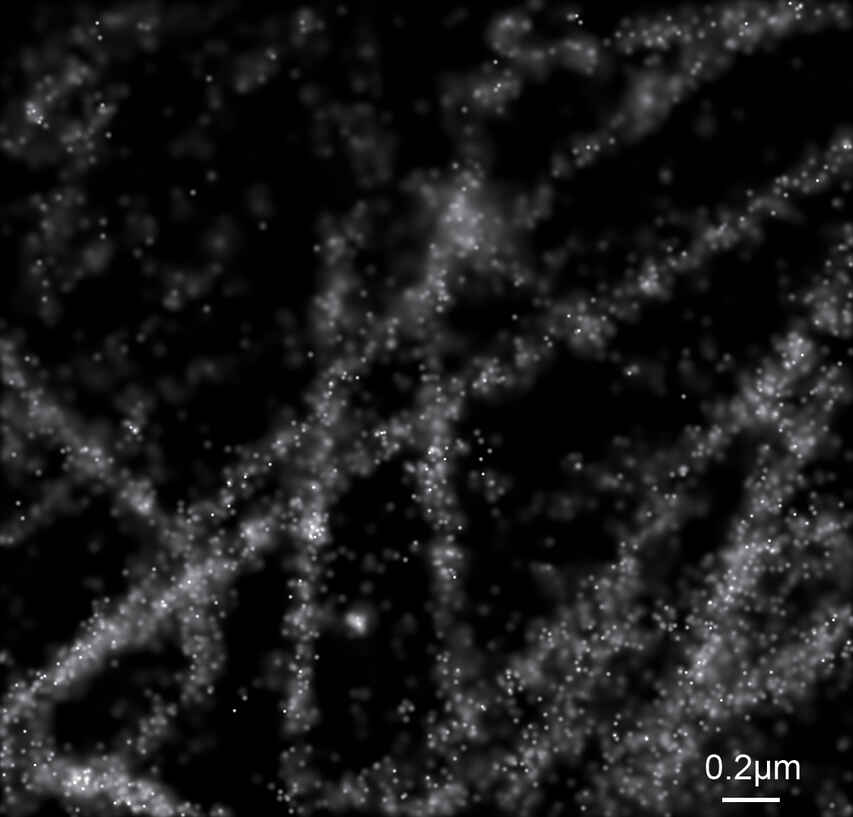 N-STORM | Super-Resolution Microscopes | Products | Nikon Instruments Inc.