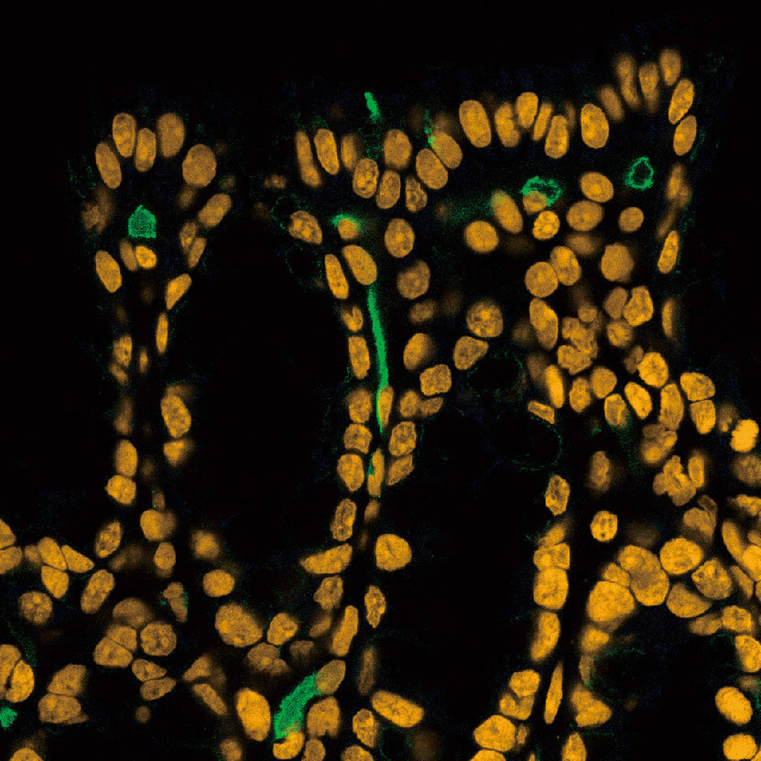 CFI プランアポクロマート Lambda D シリーズ | 対物レンズ | 製品情報 | 株式会社ニコンソリューションズ