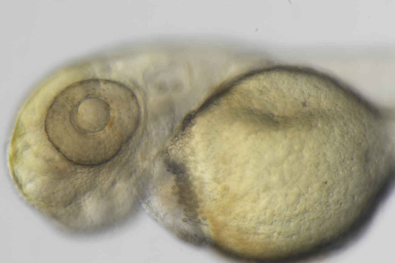 SMZ25 / SMZ18 | Stereo Microscopes | Nikon Instruments Products | Nikon ...