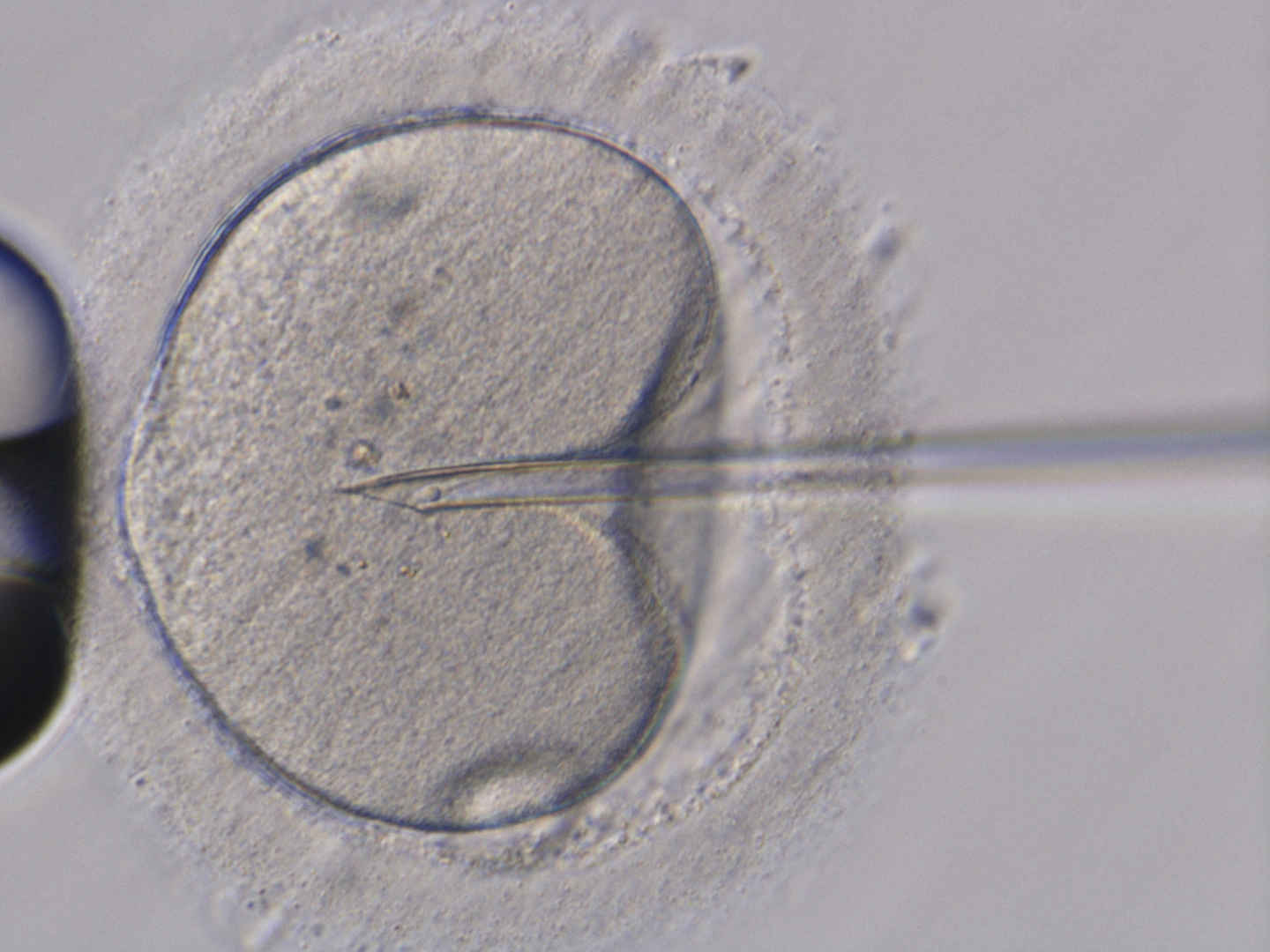 ECLIPSE Ti2-U IVF | Inverted Microscopes | Products | Nikon Instruments ...