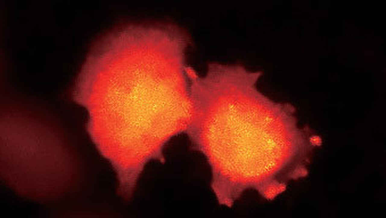 ECLIPSE Ti2 Series | Inverted Microscopes | Nikon Instruments Products ...