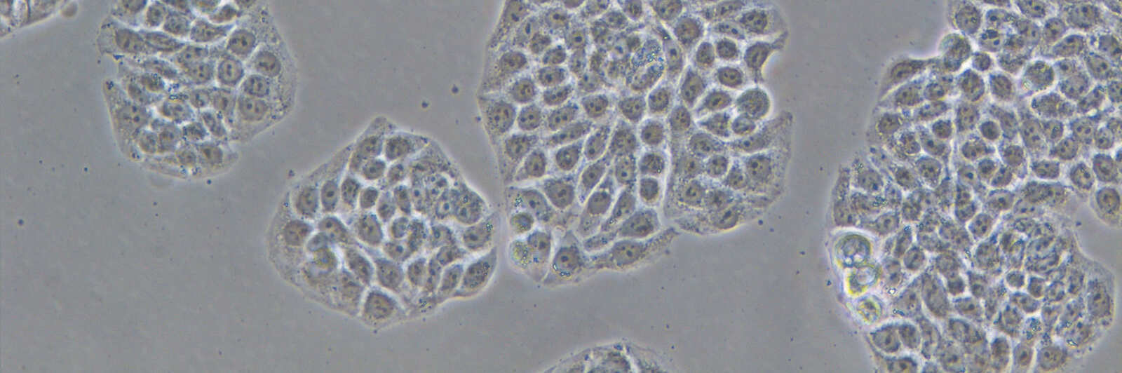 ECLIPSE Ts2 | Inverted Microscopes | Nikon Instruments Products | Nikon ...