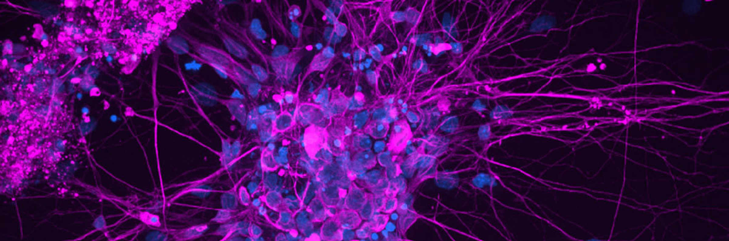 Crest X-Light V3 | Crest X-Light Series | Confocal Microscopes ...
